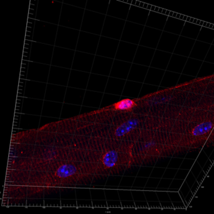 Prix de thèse SFBD 2019: Dr. Meryem Baghdadi - SFBD