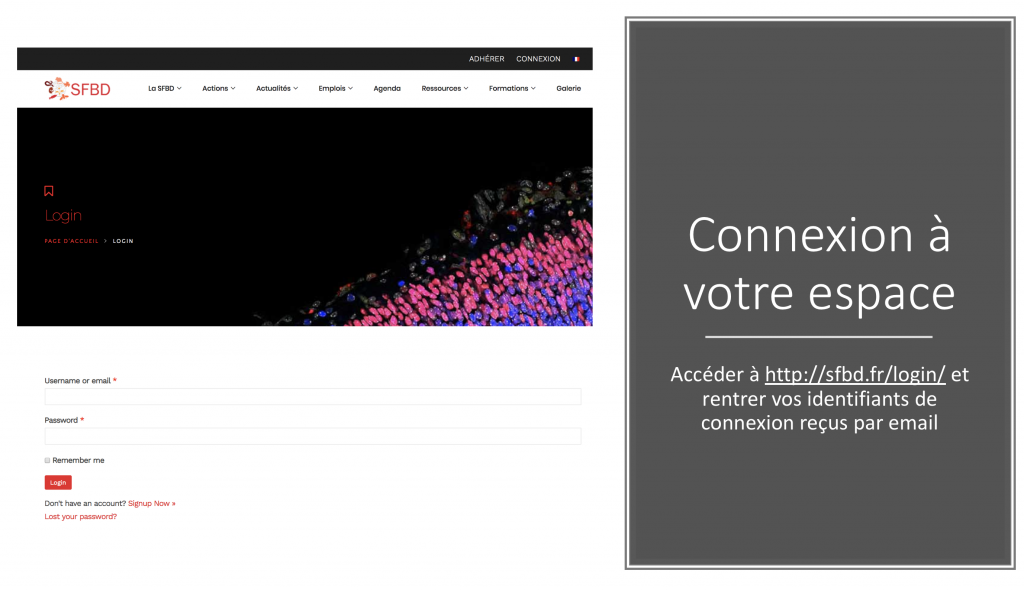 FAQ's : comment publier une actualité sur le site de la SFBD