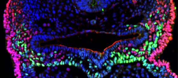 Postdoctoral position - Heart Development and Rare Diseases - SFBD