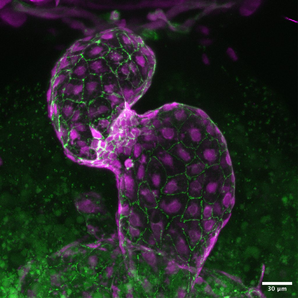 Prix de thèse SFBD 2022: Dr. Hélène Vignes - SFBD