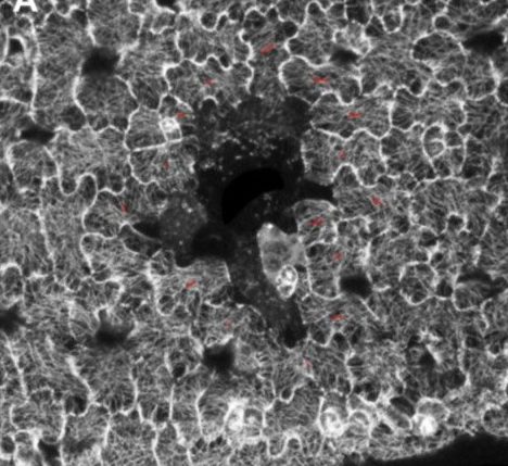 Accessit 2023: Dr. Alice Malivert - SFBD